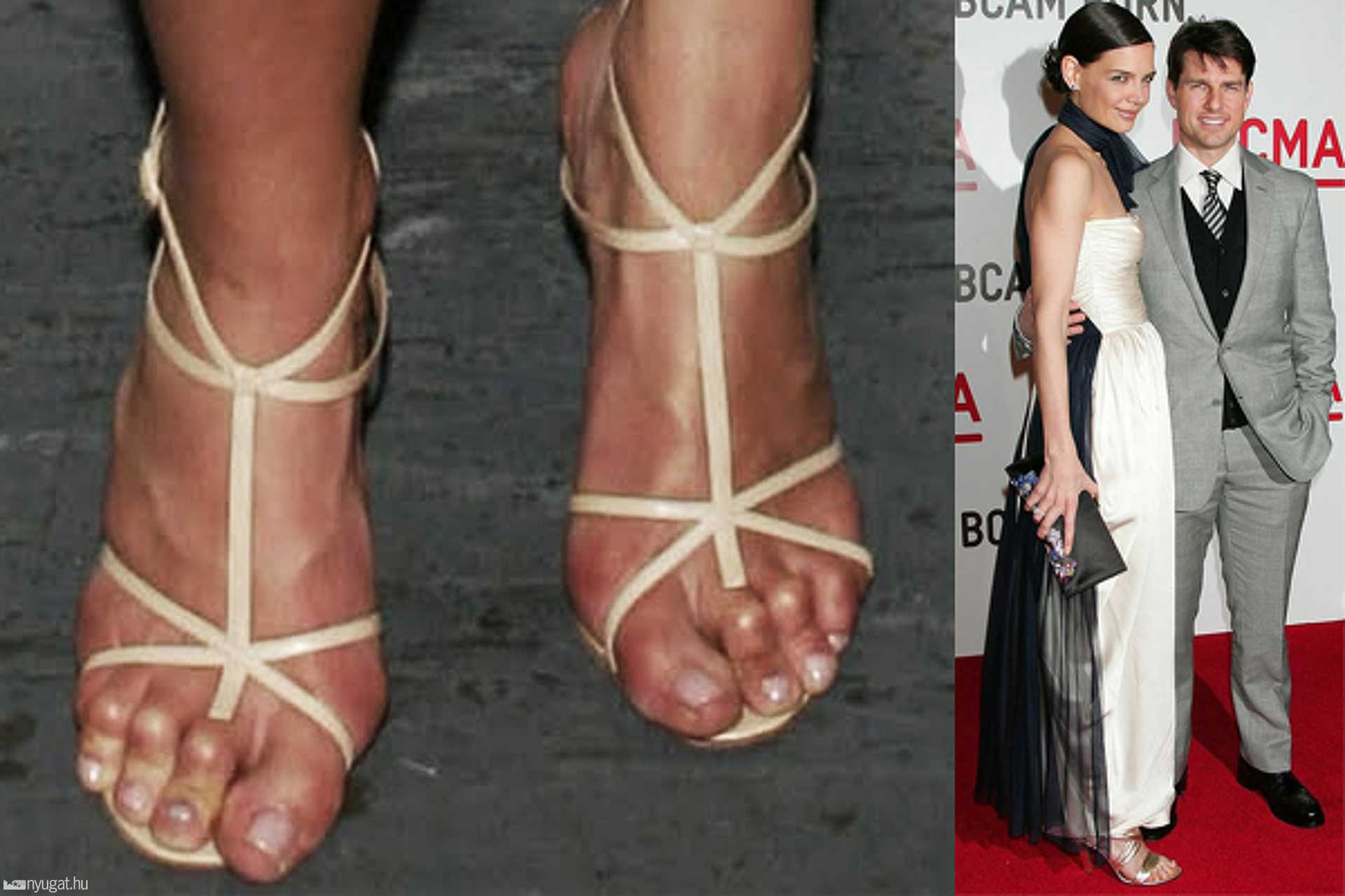 7 csúnya lábú celeb, akivel nem járnánk egy cipőben